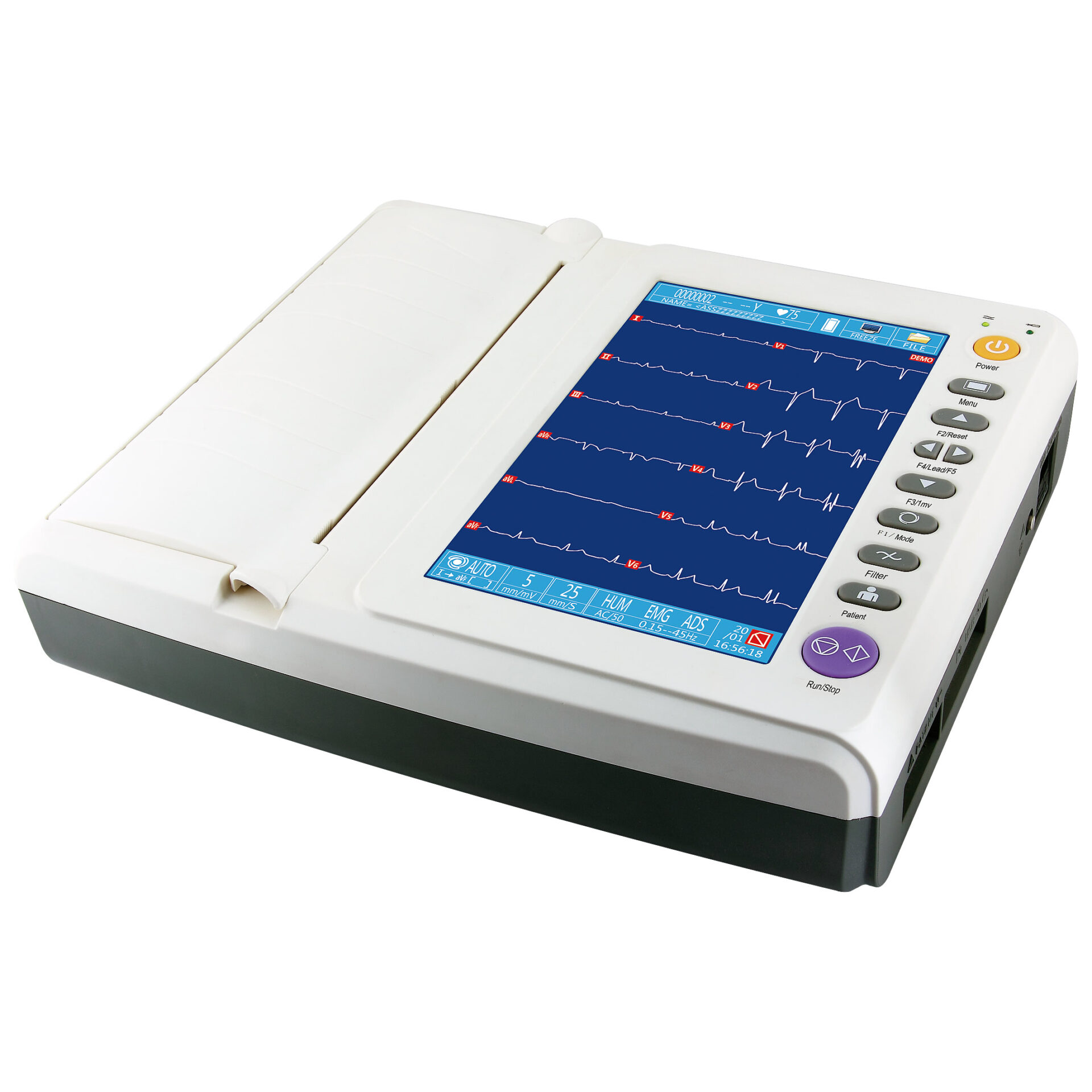 WMC-RC-ECG3312G 12 Channel ECG Machine – World Medical Corp